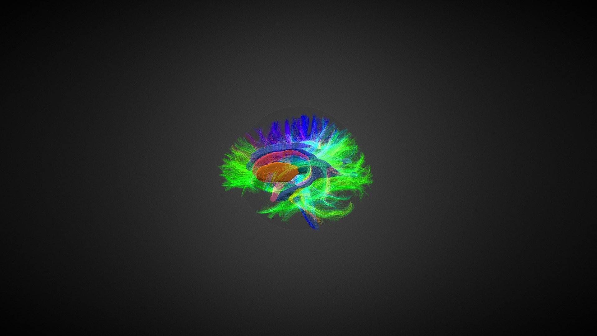 Brain structures with DTI - 3D model by UBC Medicine - Educational ...