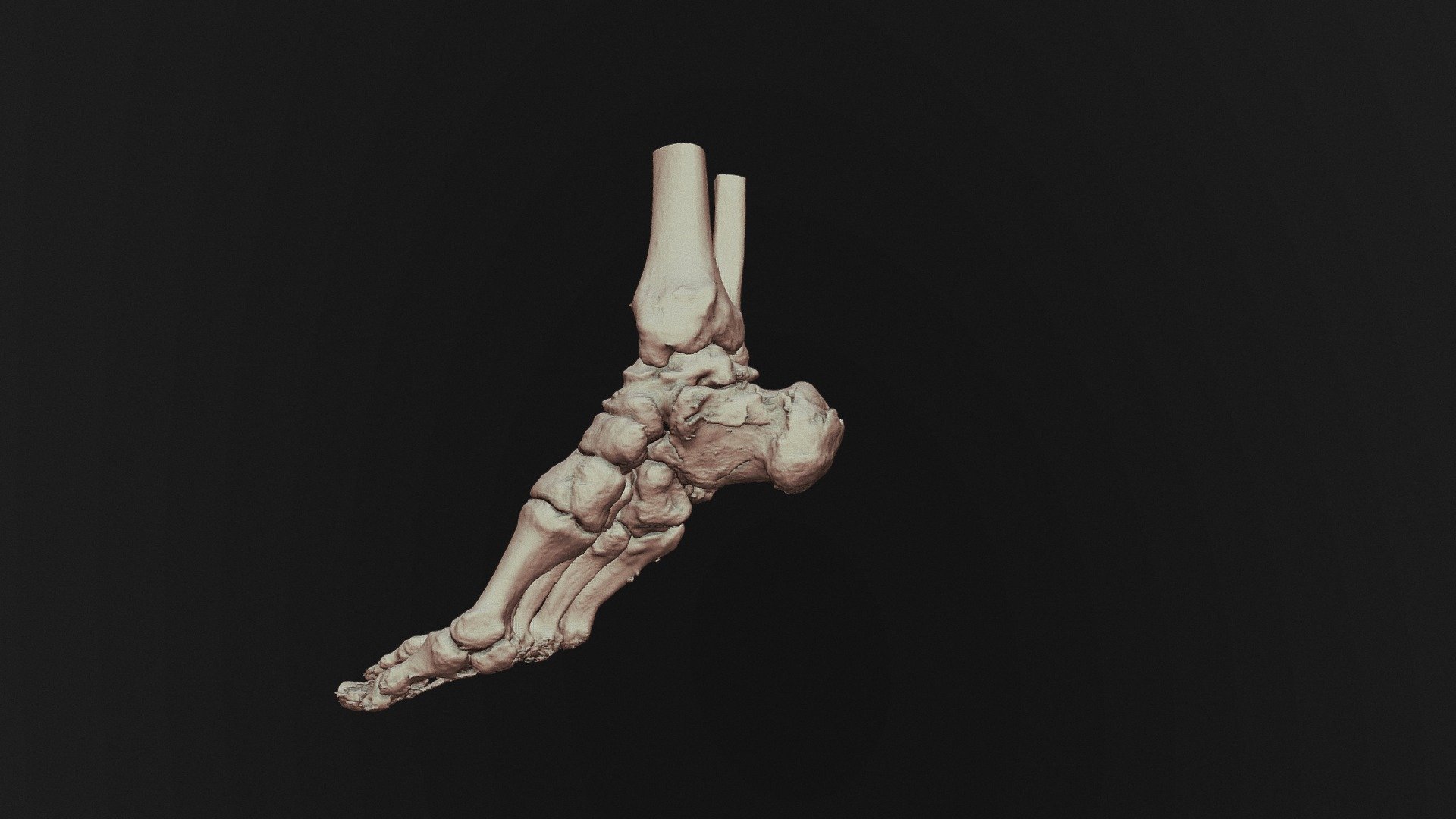 calcagno finale - 3D model by tsrmadmin [7948e16] - Sketchfab
