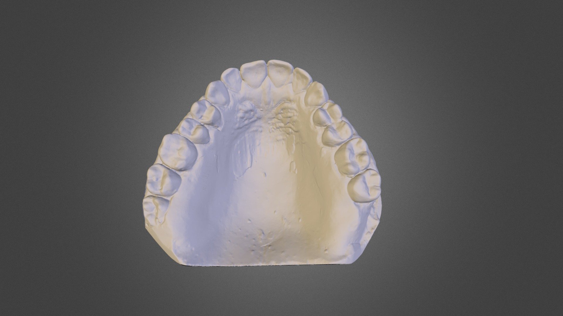 Diagnostical plaster upper jaw model - 3D model by CaptainMESH [795de67 ...