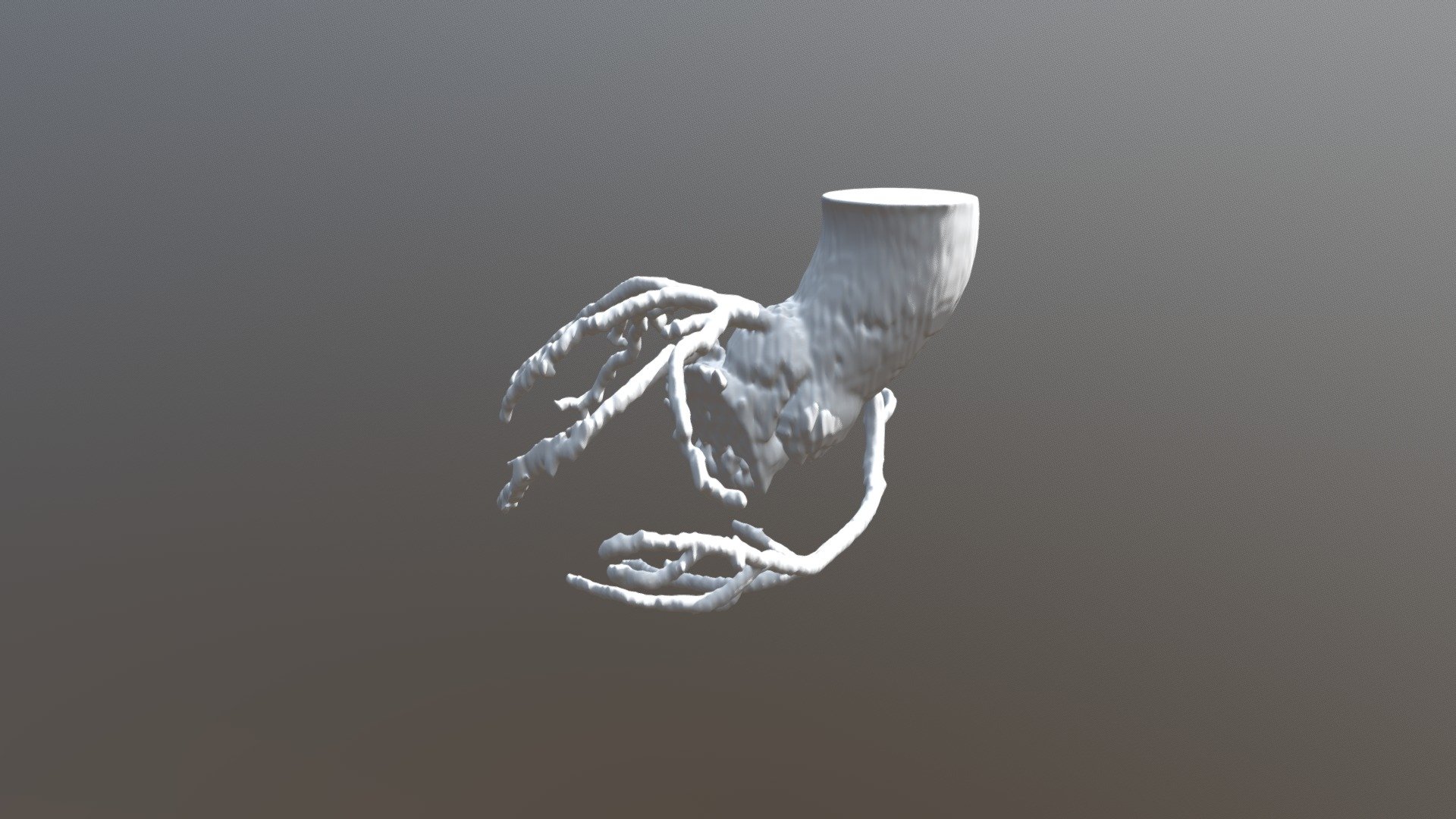 Coronary Tree - 3D model by Caring Research (@caringresearch) [7983c3e ...