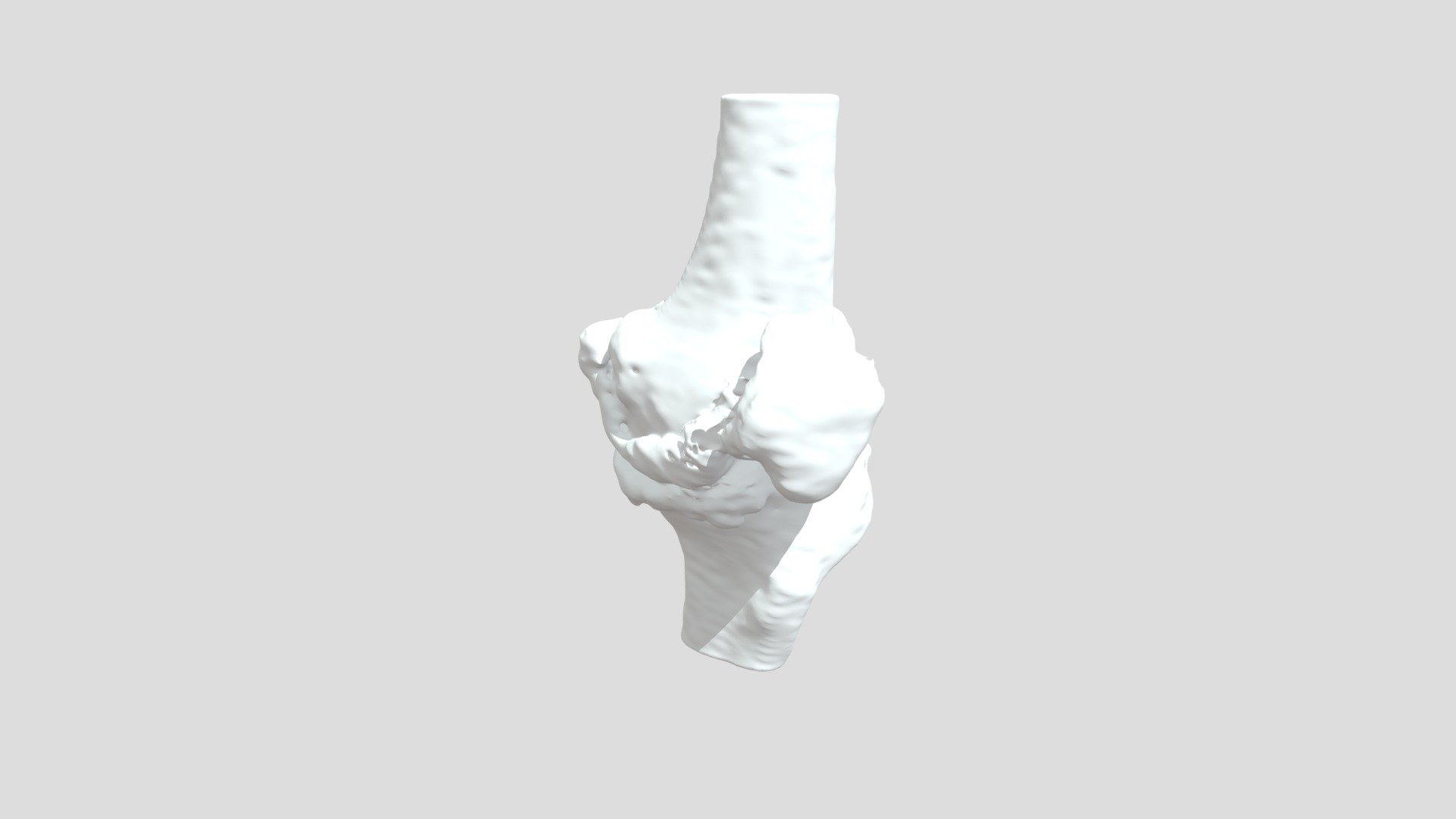 Segmentation Kant Pat Lt Bone - 3D model by curisdata.science [79931cf ...