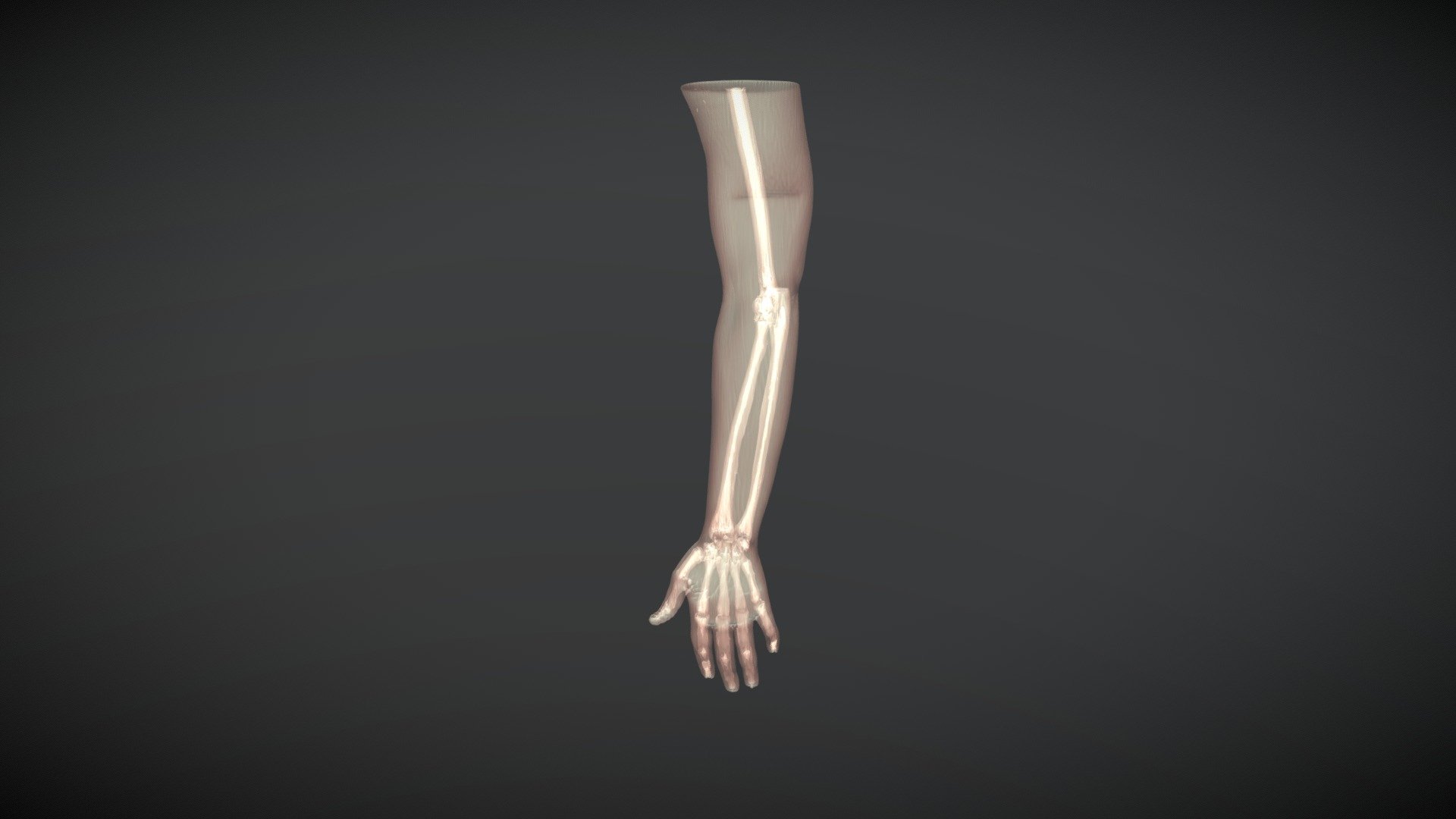 Arm Segmentation (Bones, Muscle, and Skin) - 3D model by cszulkin ...