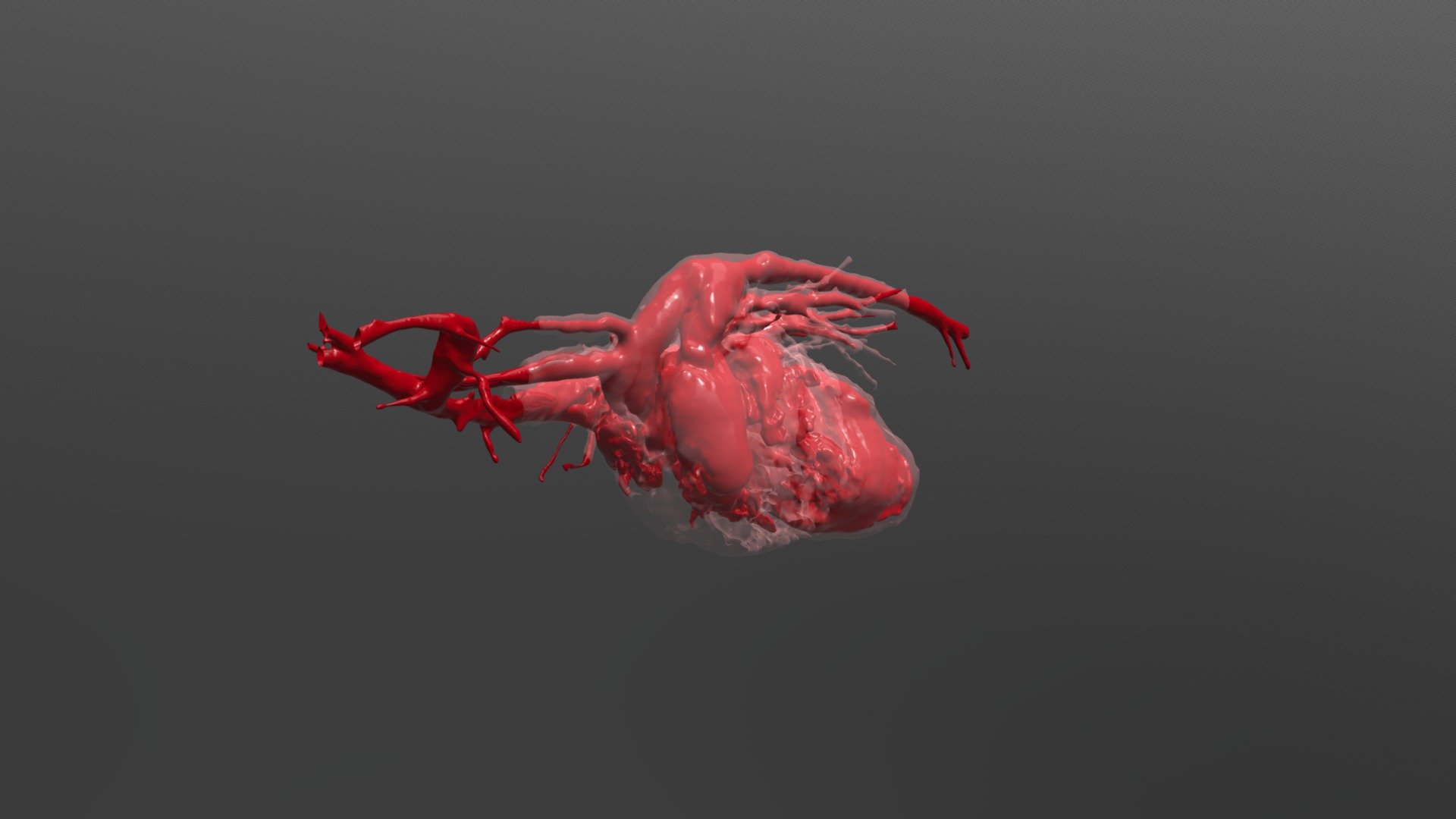 Canine Patent Ductus Arteriosus (Long Ampulla) - 3D model by ...