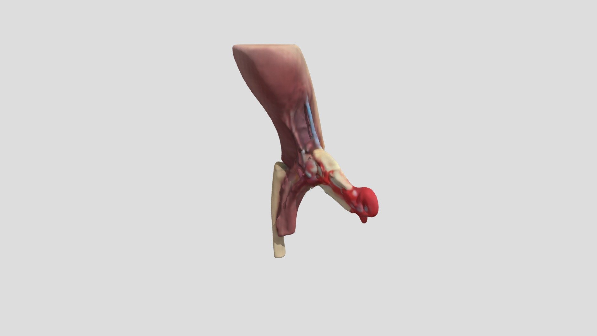 5a45a94461b8_8ea434df98a7_acute_appendicitis_ - Download Free 3D model ...