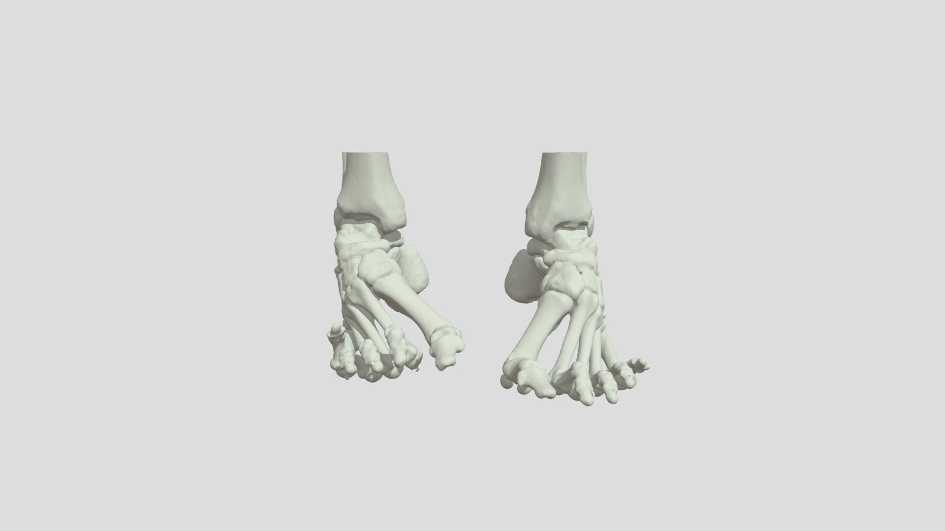 Cavovarus Deformity, Feet (S0356) - 3D model by NCH Advanced Projects ...