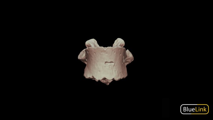 Thoracic Vertebrae - T10, Labeled - 3D model by Bluelink Anatomy ...