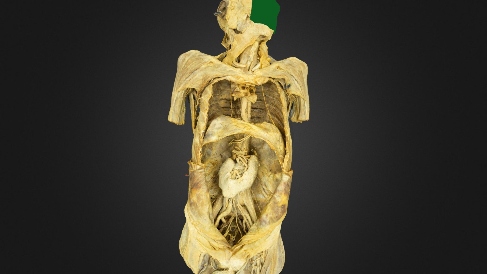 Diaphragm Expanded - 3D model by UBC Medicine - Educational Media ...