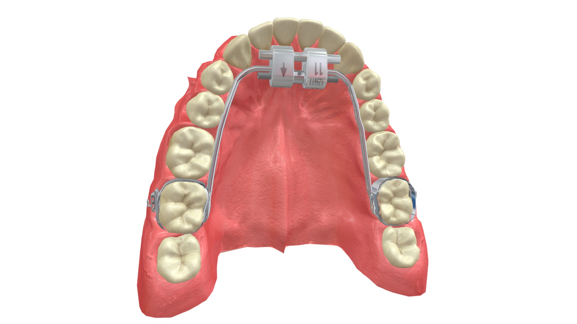 2. FIXED LOWER EXPANDER - 3D model by Interactive 3D Data ...