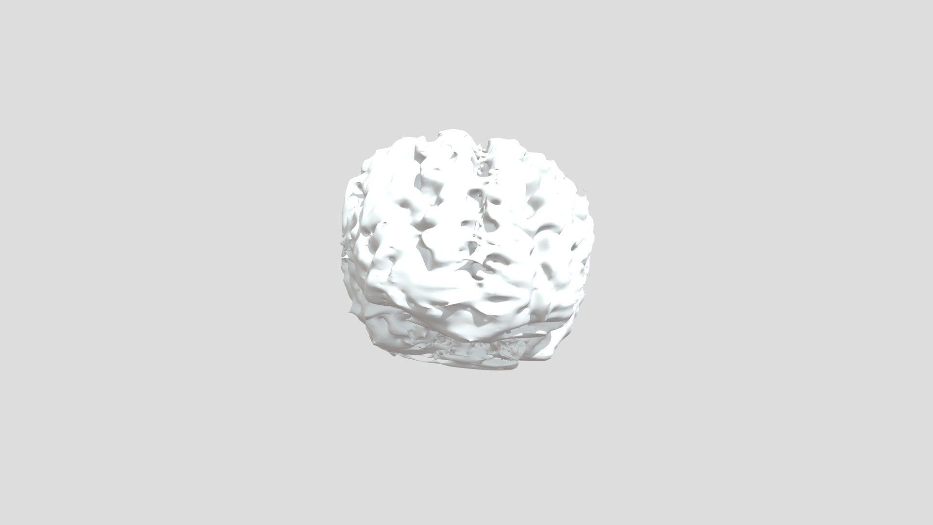 Stroke Patient Brain_Segmentation_周靖彤 - 3D model by chewjingtung1 ...