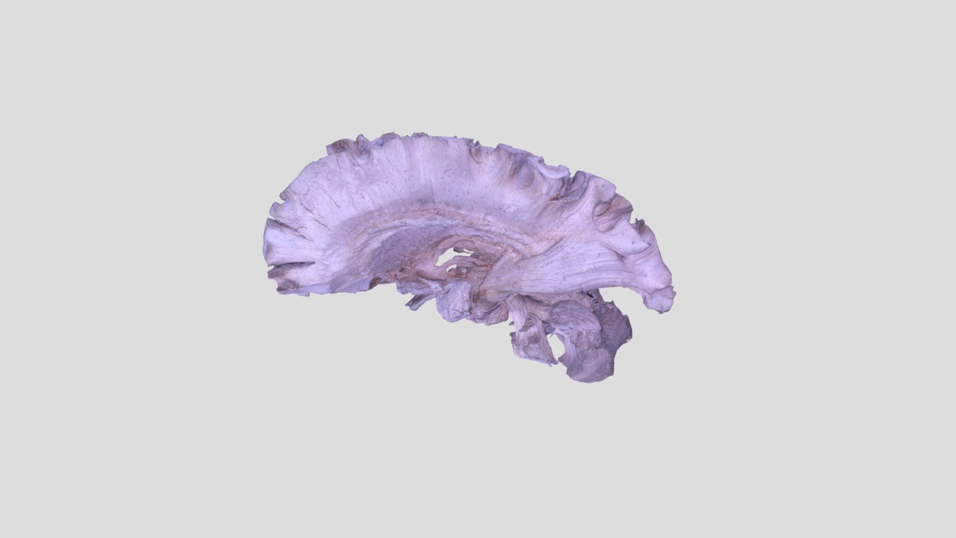 Brain - Fiber dissection study - Download Free 3D model by ...