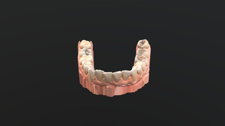 Dental 3D models - Sketchfab