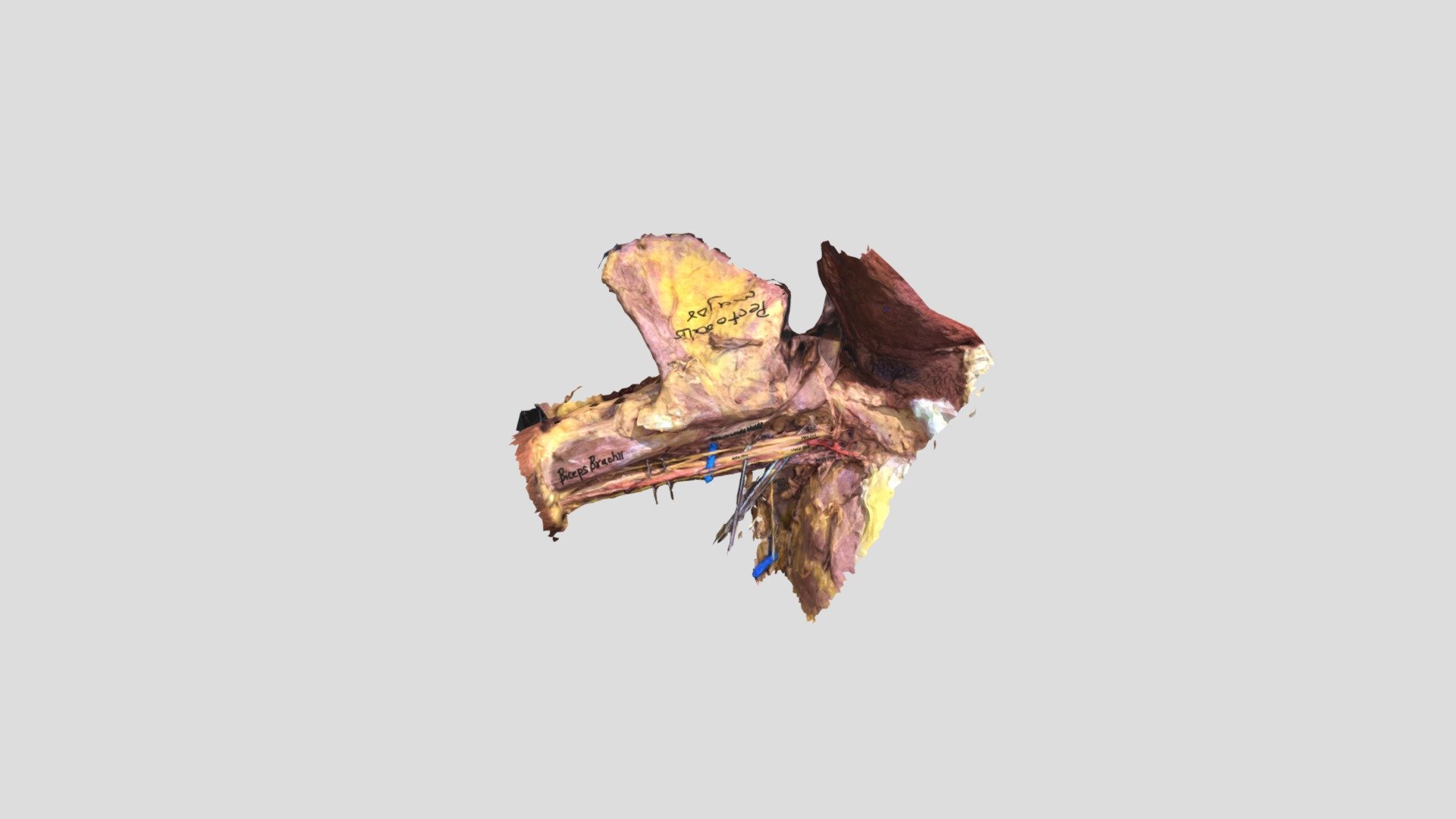 Copy-1 Brachial Plexus With Markings - copy 4 - 3D model by prajjawalit ...
