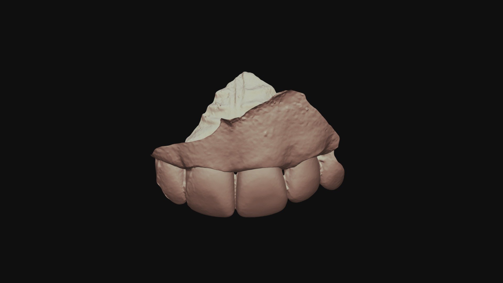 group 11 Class 3 Tooth 9 version 1 - Download Free 3D model by UMdental ...