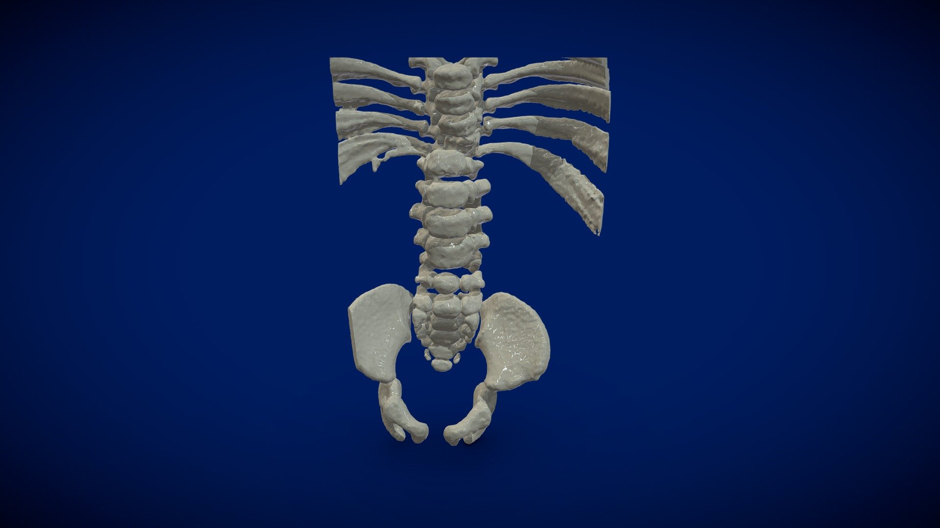 CBD - LOMBAR - 3D model by Dr. Samuel Damin (@sdamin) [7cbcddb] - Sketchfab