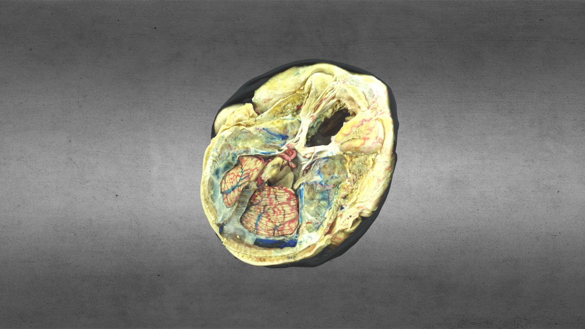 Skull Base_PPsb exposure - 3D model by vv (@verav) [7cd4cd9] - Sketchfab