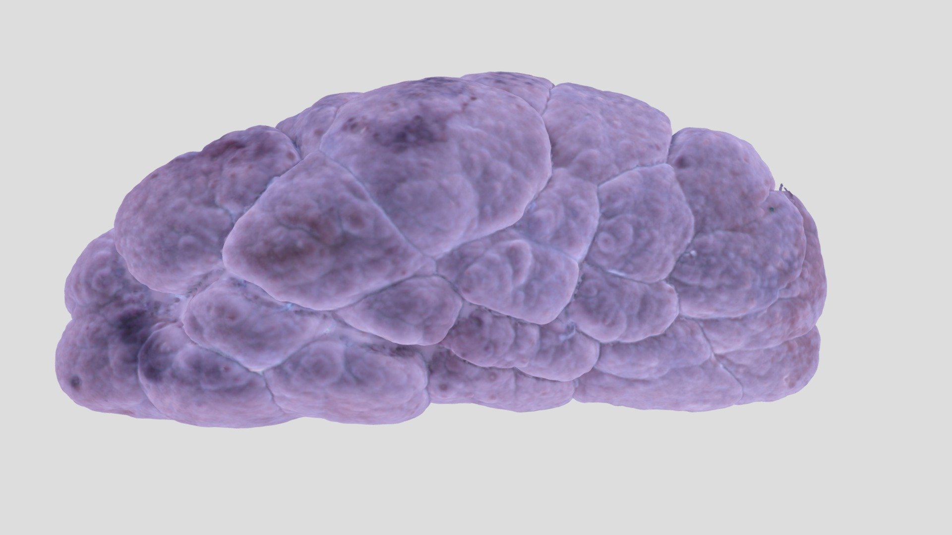 Kidney, chronic pyelonephritis (cow) - 3D model by University of ...