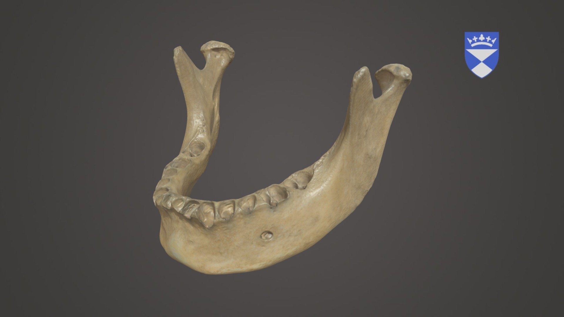 Mandible - 3D model by University of Dundee, CAHID (@anatomy_dundee ...