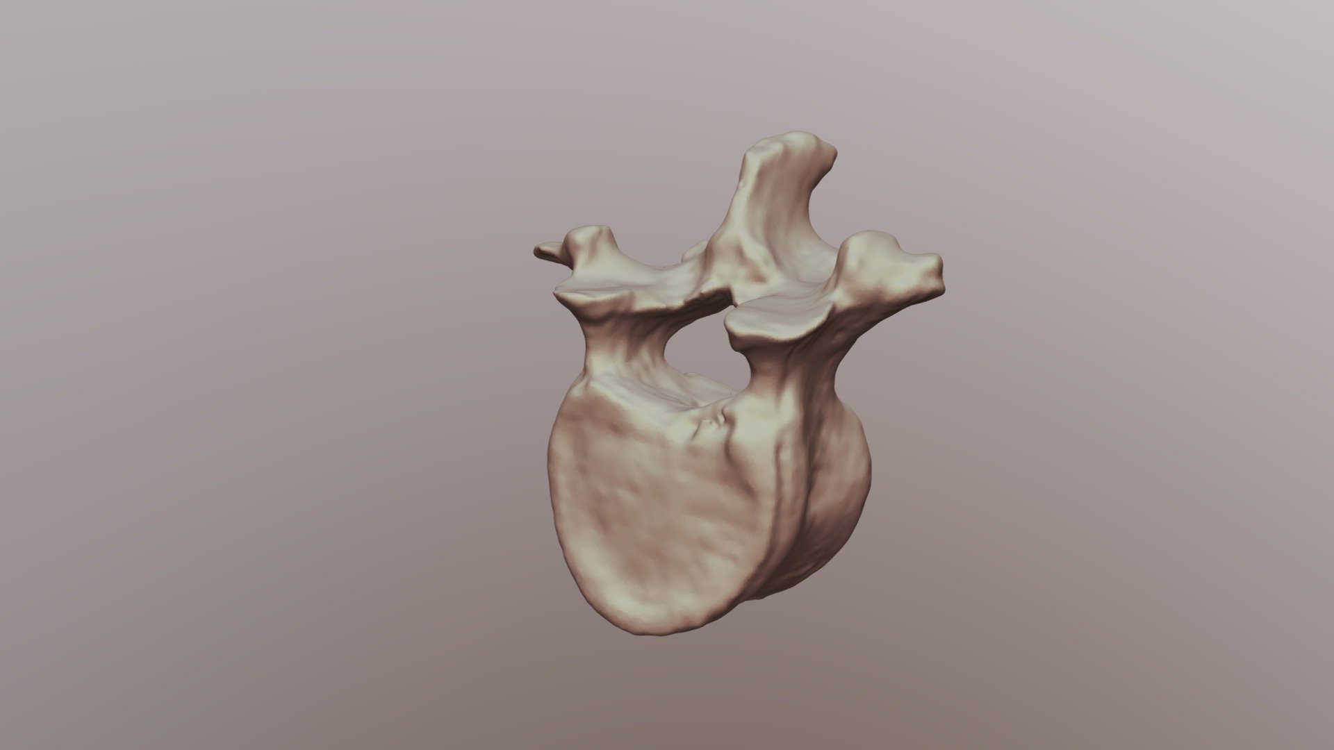 Human Lumbar Vertebrae - 3D model by OU Libraries (@libedge) [7d5de89 ...