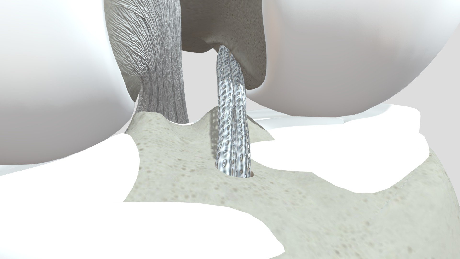 JewelACL™ Total Tissue Graft Sparing technique - 3D model by Xiros ...