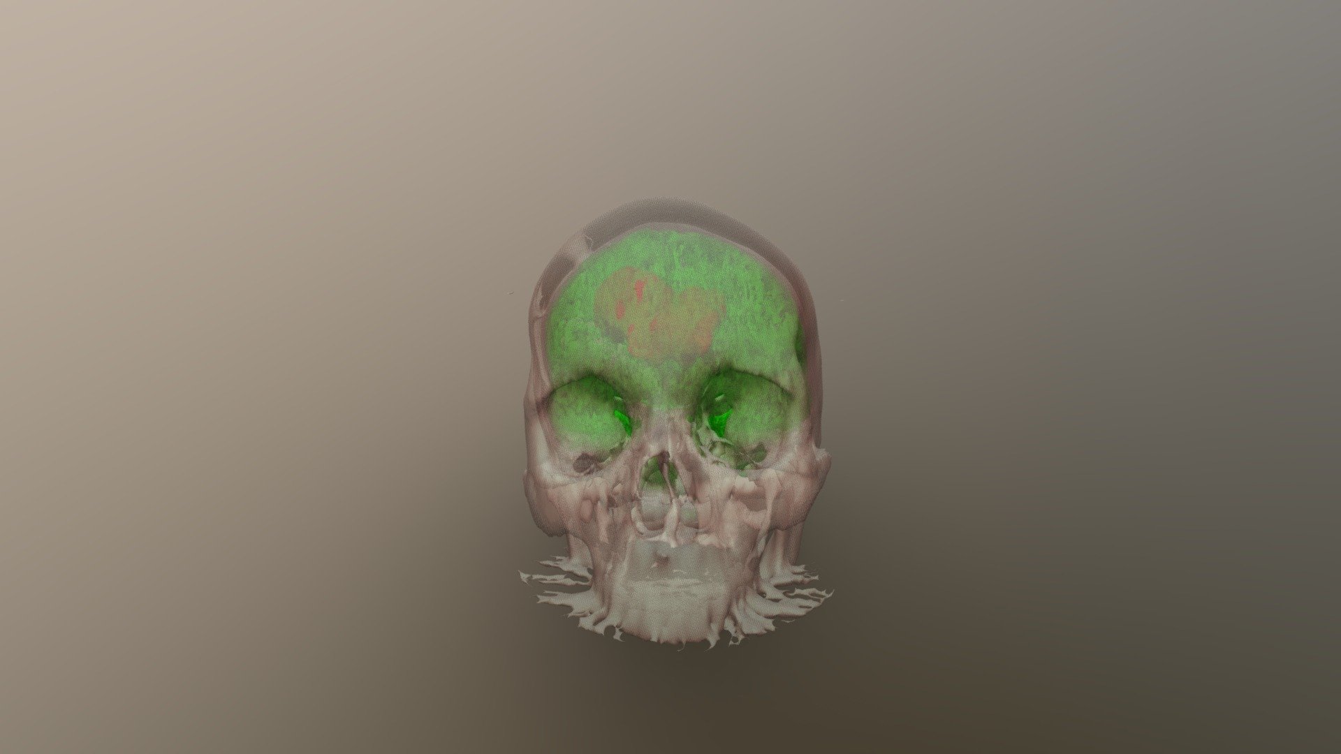 ANAT6205-Group2CJPT Cerebrix Segmentation - Download Free 3D model by ...