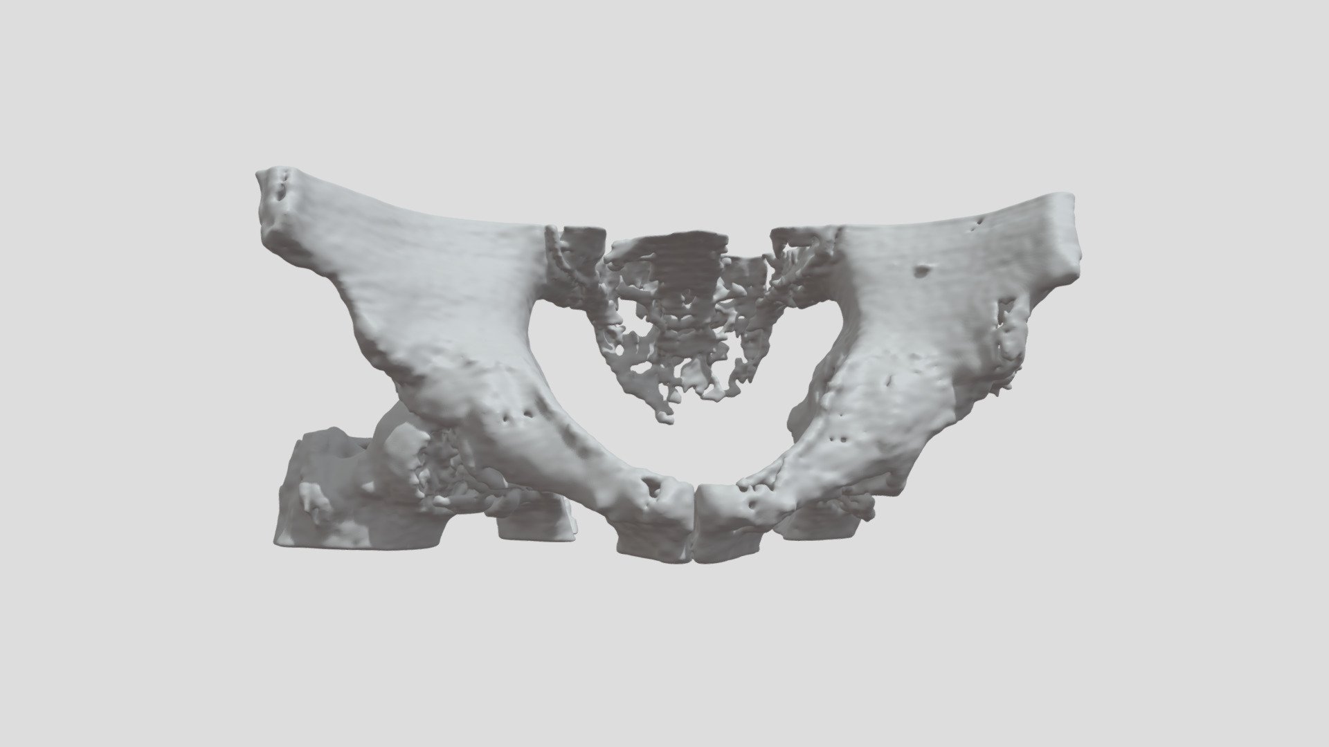 acetabulum - 3D model by mboreman [7d924ff] - Sketchfab
