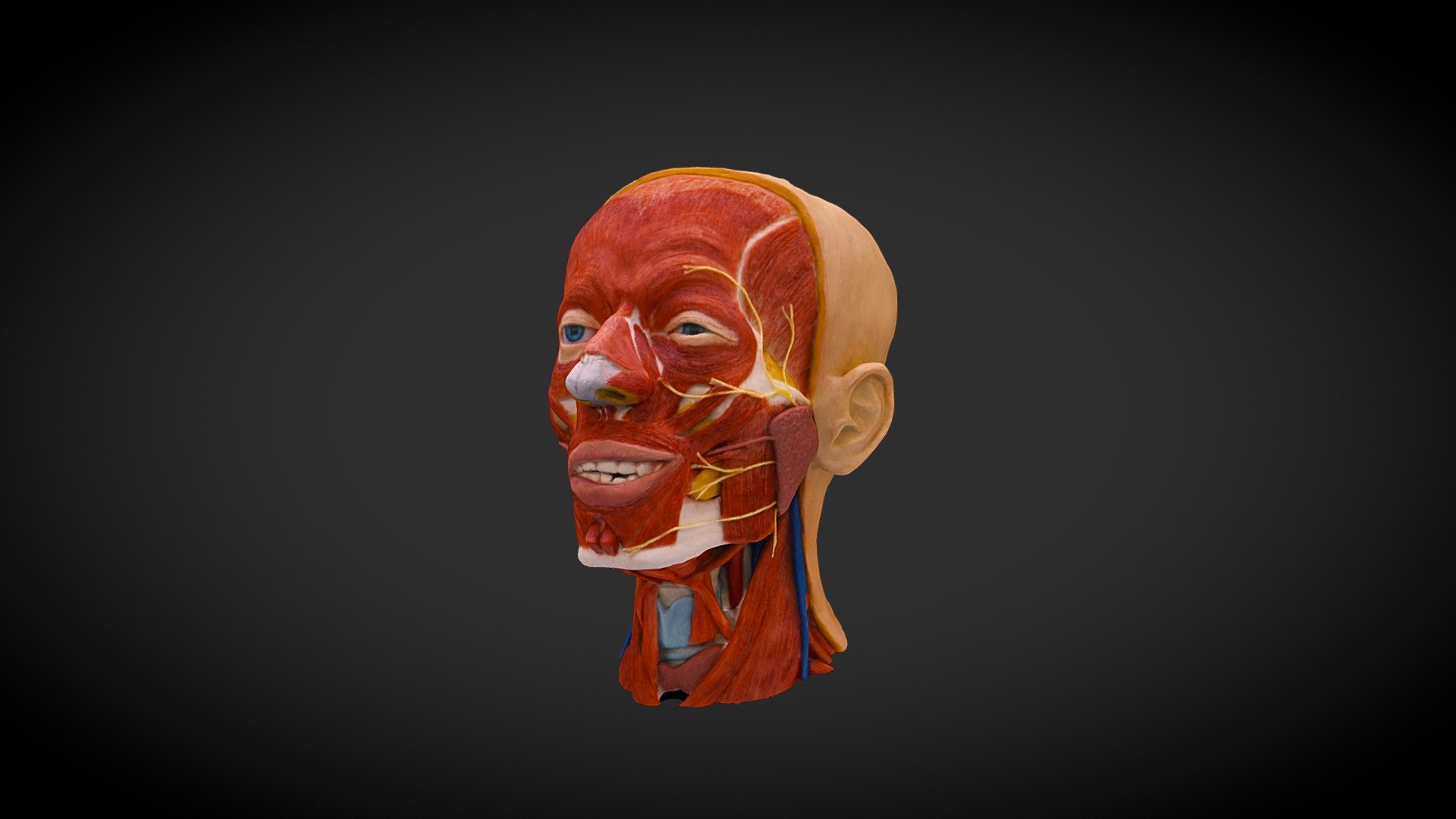 Head and Neck Écorché on Bell’s Palsy - 3D model by Shulei_Xiao ...