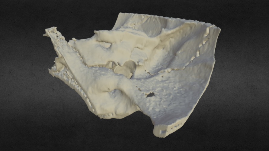 Microtia - 3D model by RPA IAS (@kai.cheng) [7e899c8] - Sketchfab
