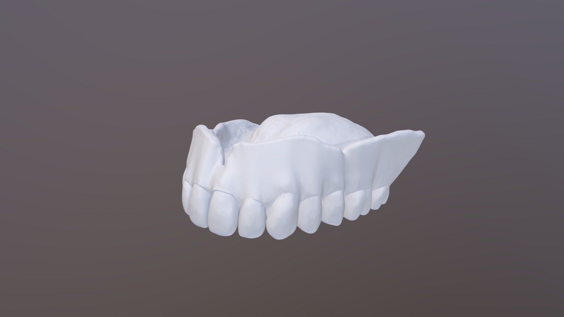 upper denture - 3D model by ramiammoun [7ea551c] - Sketchfab