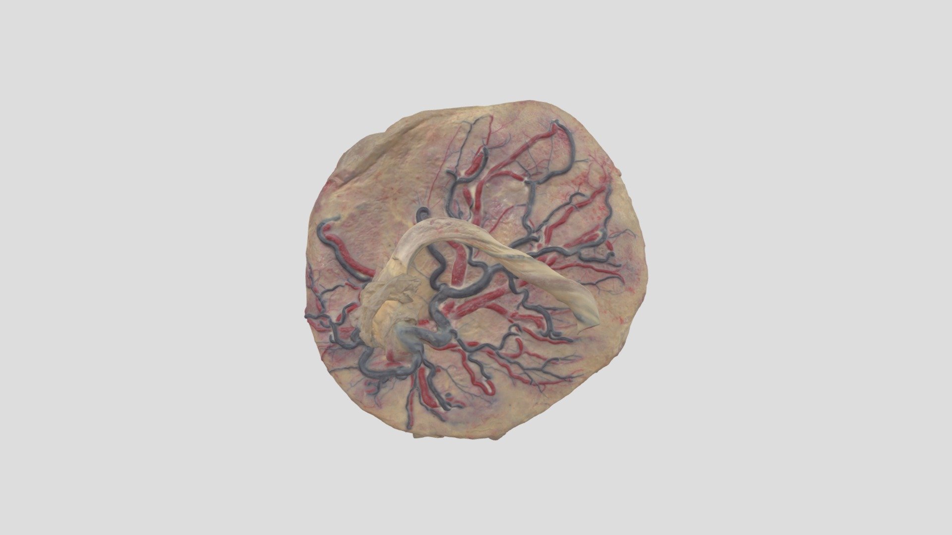 Placenta_SS - 3D model by shearjak (@shearjak-90f46f) [7eba2ab] - Sketchfab