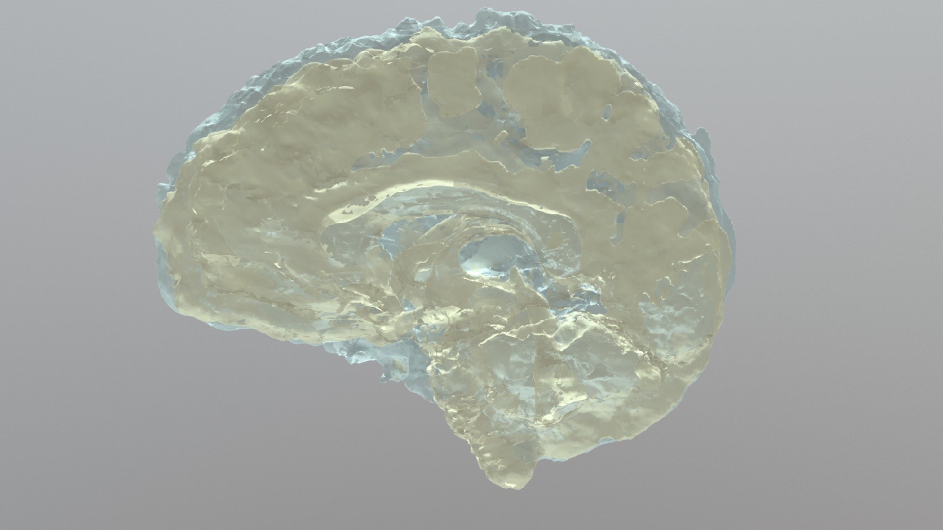 WHITE AND GRAY MATTER CT Scan Segmented - 3D model by Interactive 3D ...