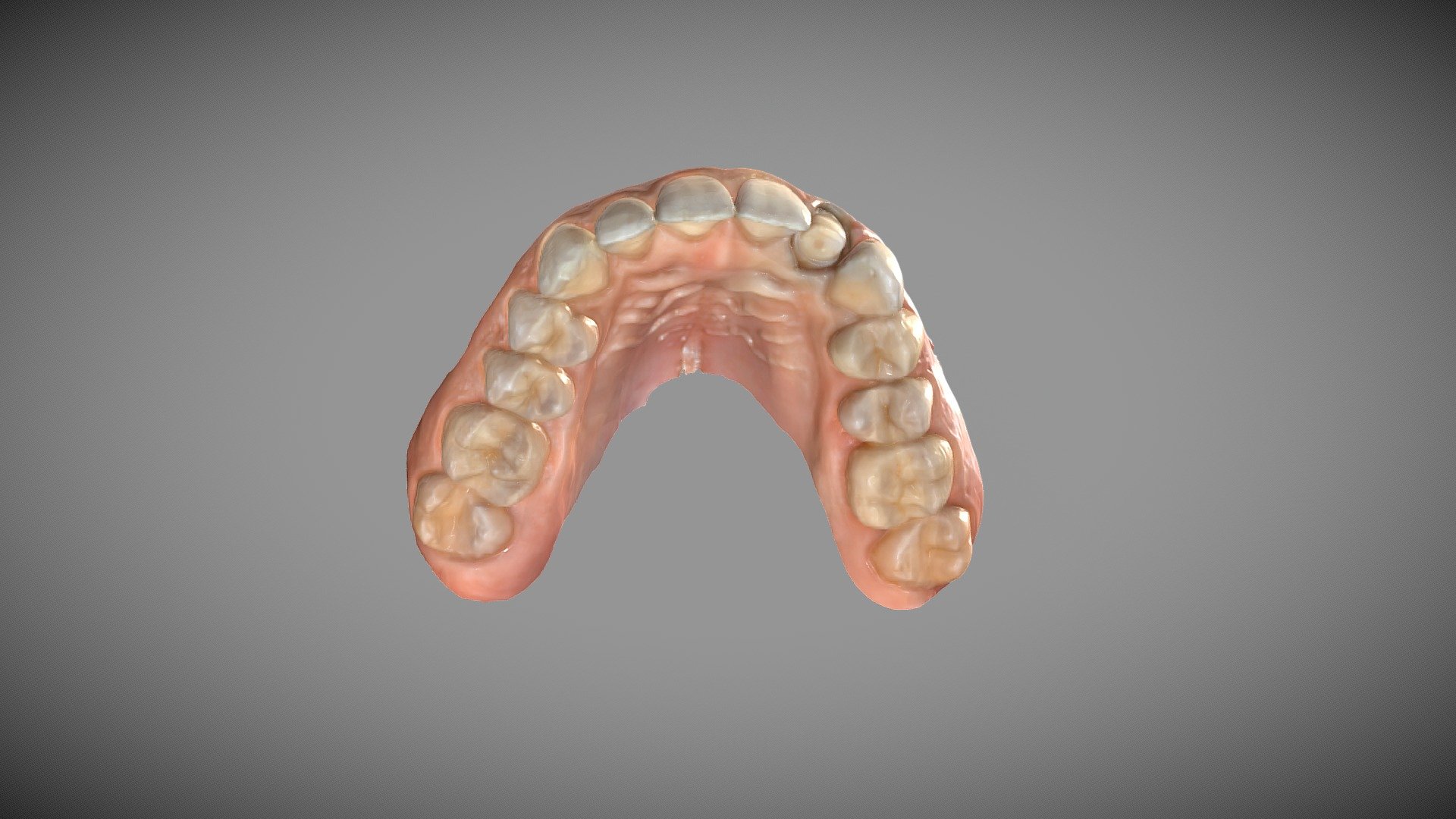 Maxillary - 3D model by ldh_smiley [7f5cce6] - Sketchfab