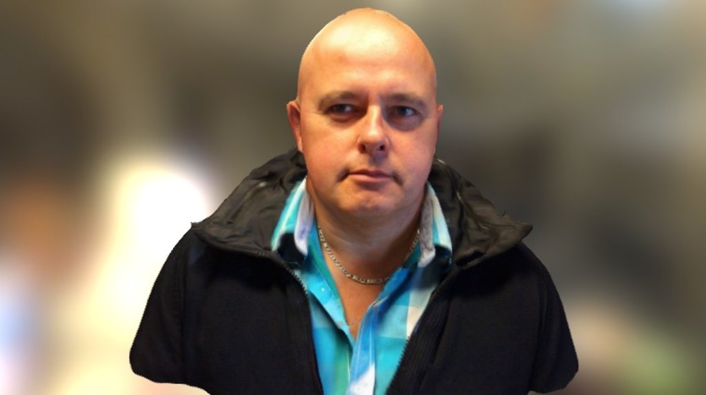 marc collard - 3D model by bop-orthopedie [7fa69cd] - Sketchfab