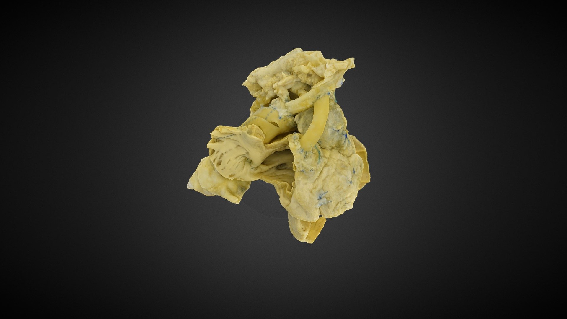 51 Interior - 3D model by CHOP Cardiac Specimens (@cardiacspecimens ...