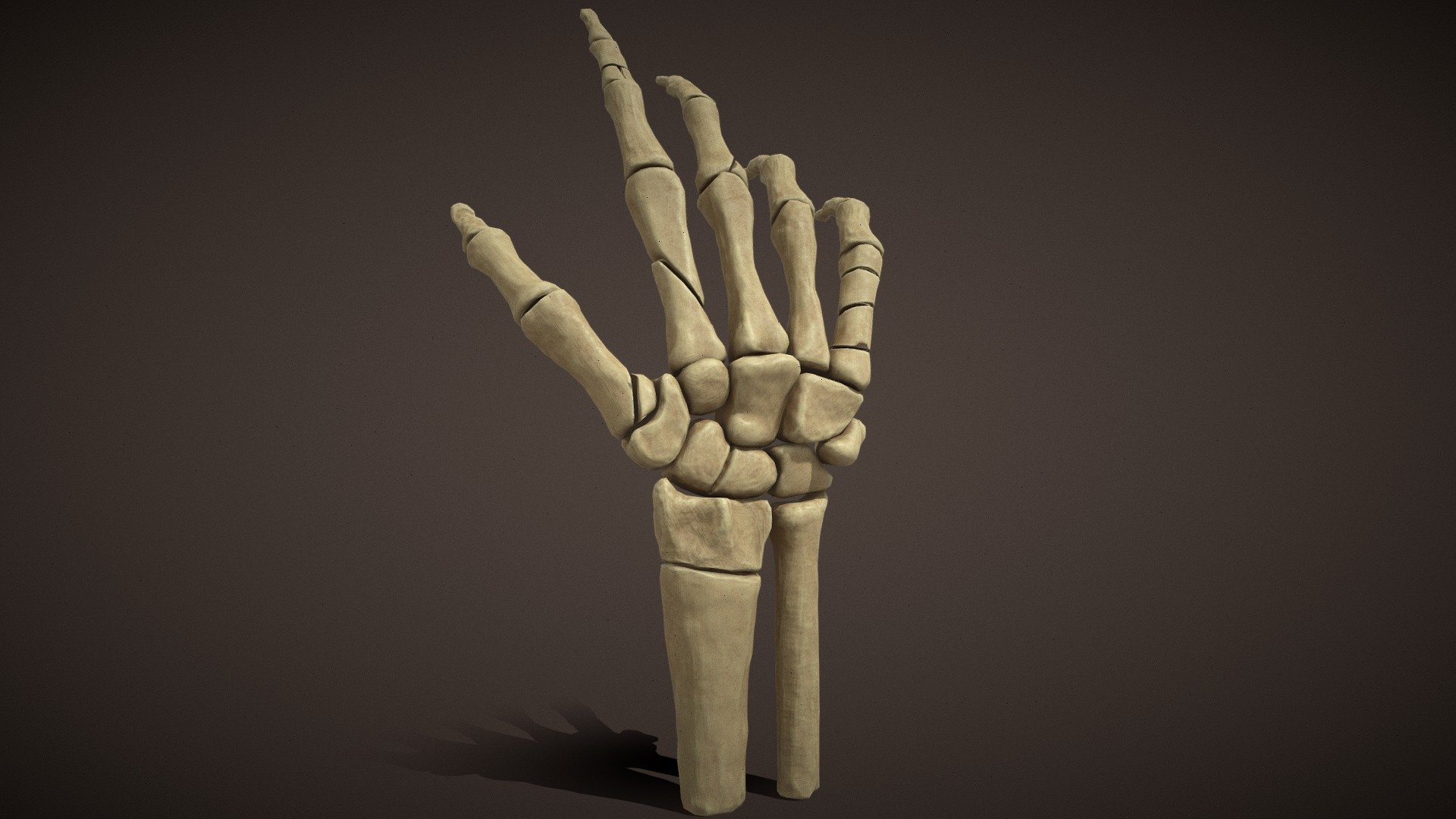 Anatomy of a hand fractures - 3D model by arloopa [7fd8a37] - Sketchfab