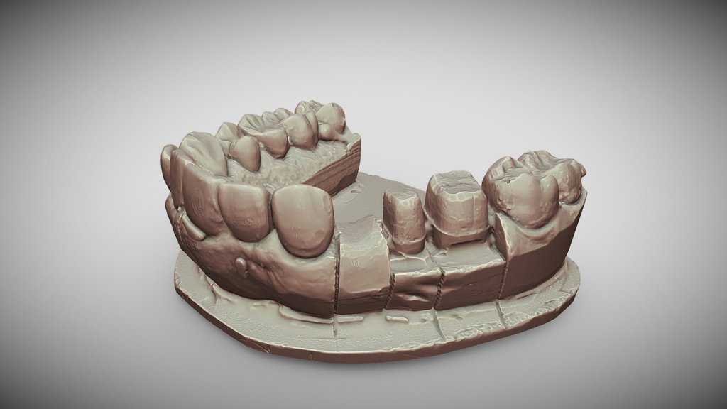 Dental Animations - A 3D model collection by BlessedMadman (@jaypalooza ...