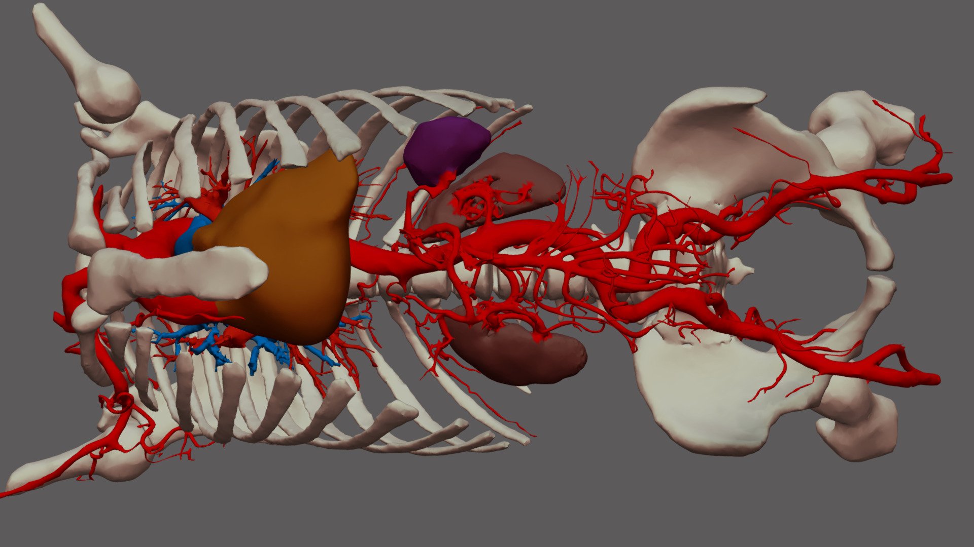 Thorax angio-CT - 3D model by Jean Francois UHL (@jef3D) [809e517 ...