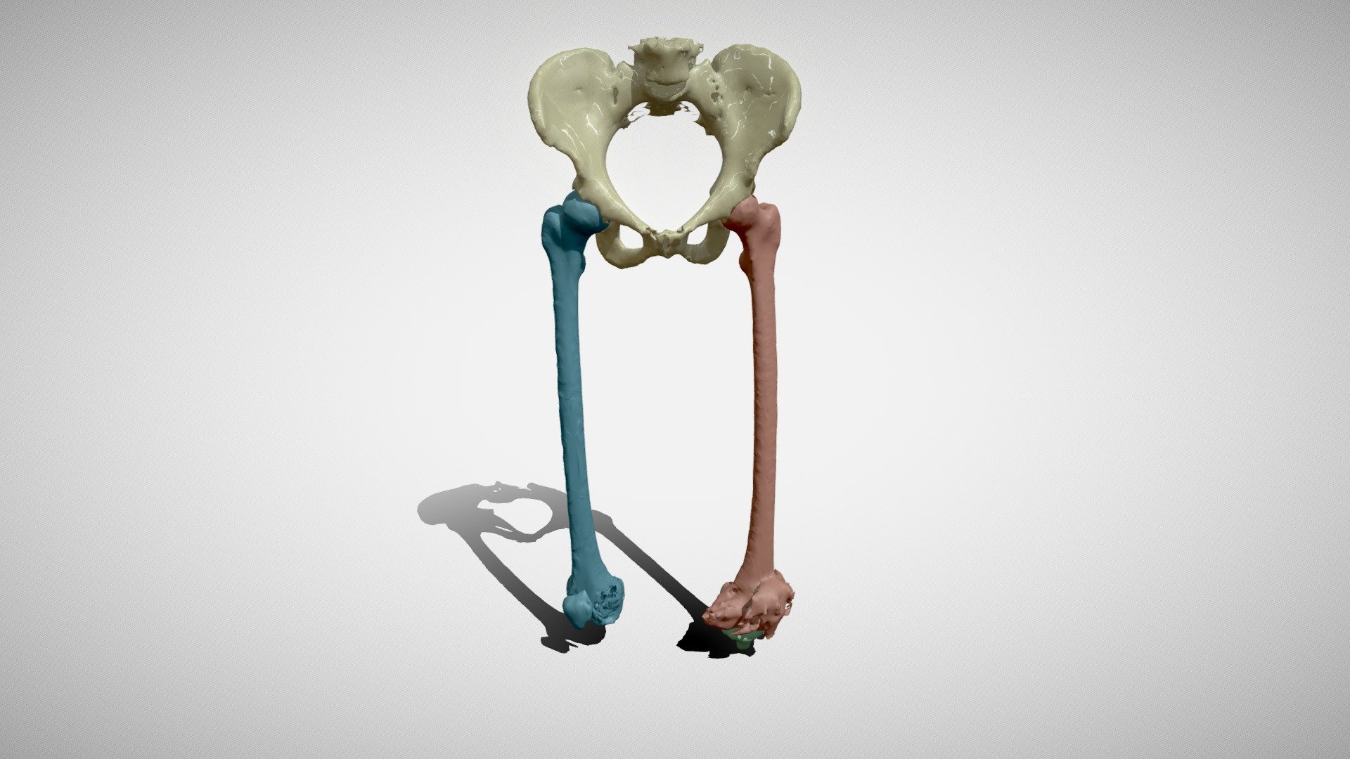 Femur Model - 3D model by emily.buchanan [80c138e] - Sketchfab