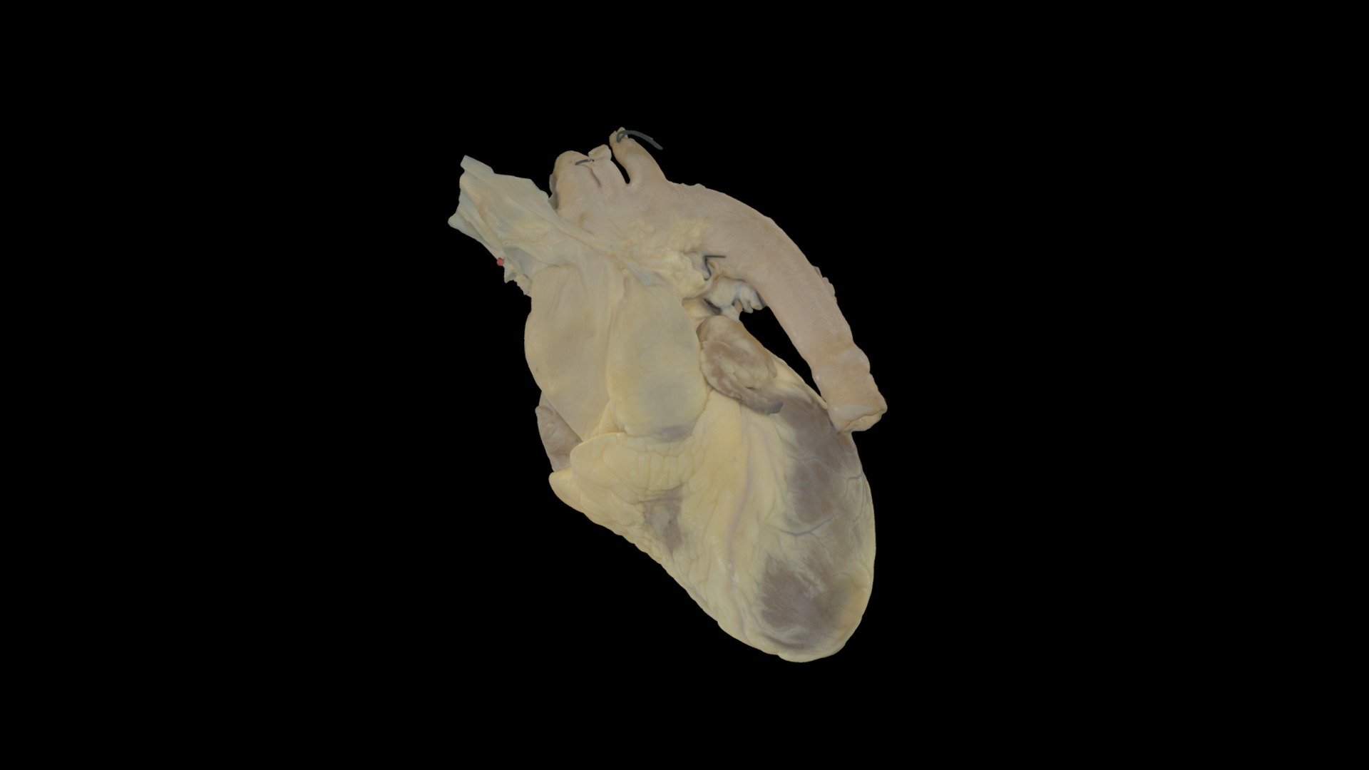 Perfusion Fixed Human Heart Donation - Download Free 3D model by ...
