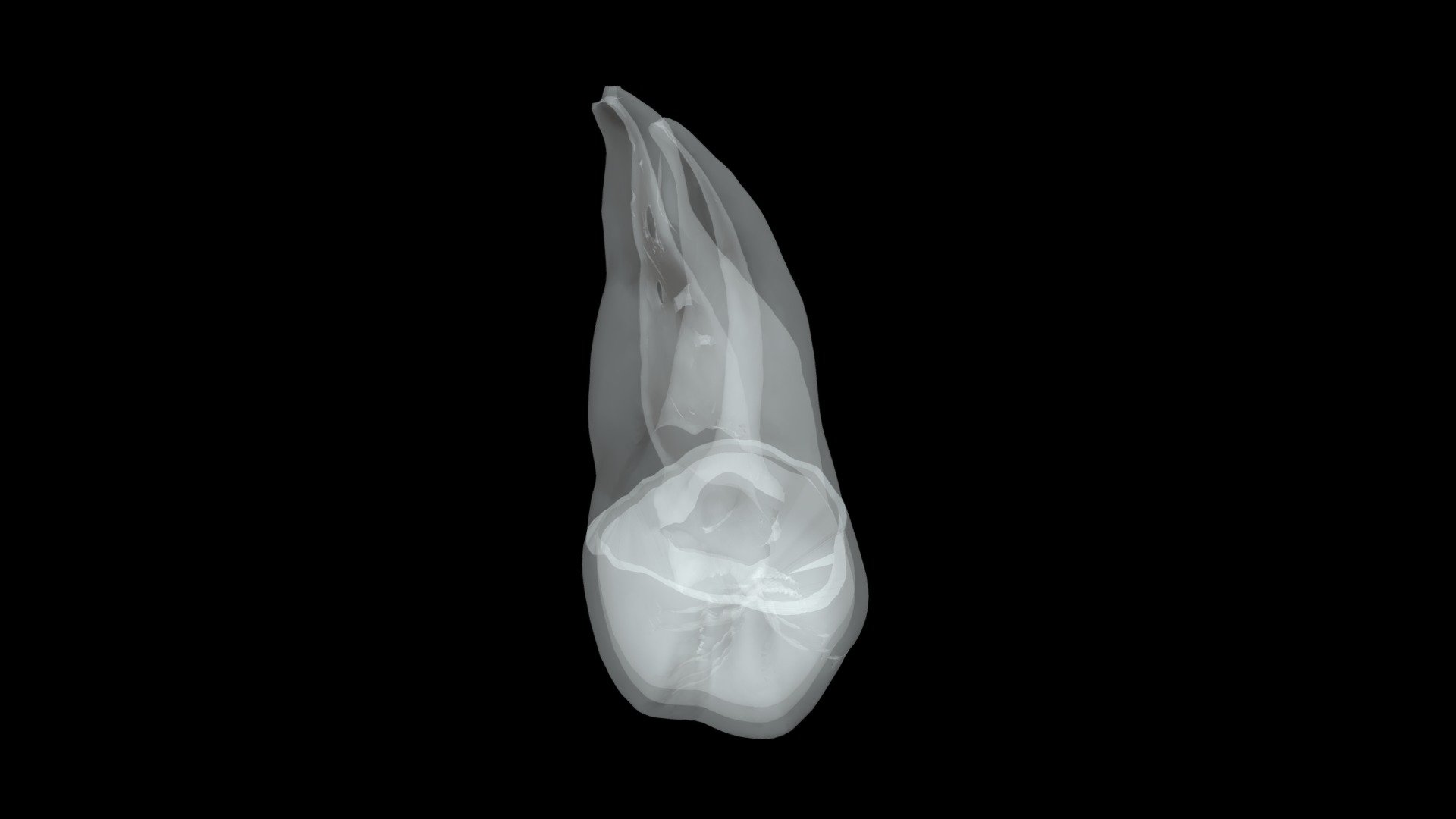 19 Difficult - 3D model by biomed3d [810ef3d] - Sketchfab
