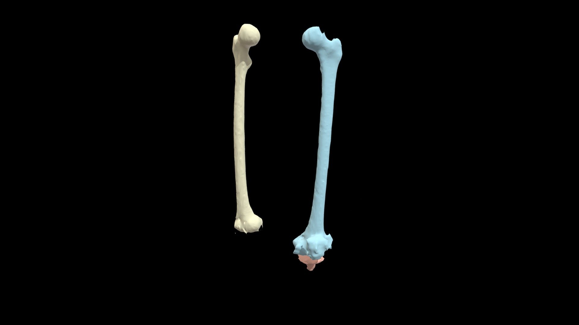 femur segmentation - Download Free 3D model by emwigdahl [81227c7 ...