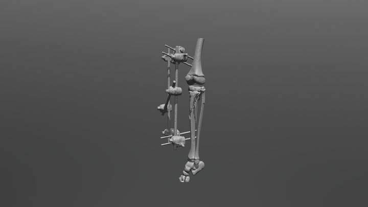 Patella 3D models - Sketchfab