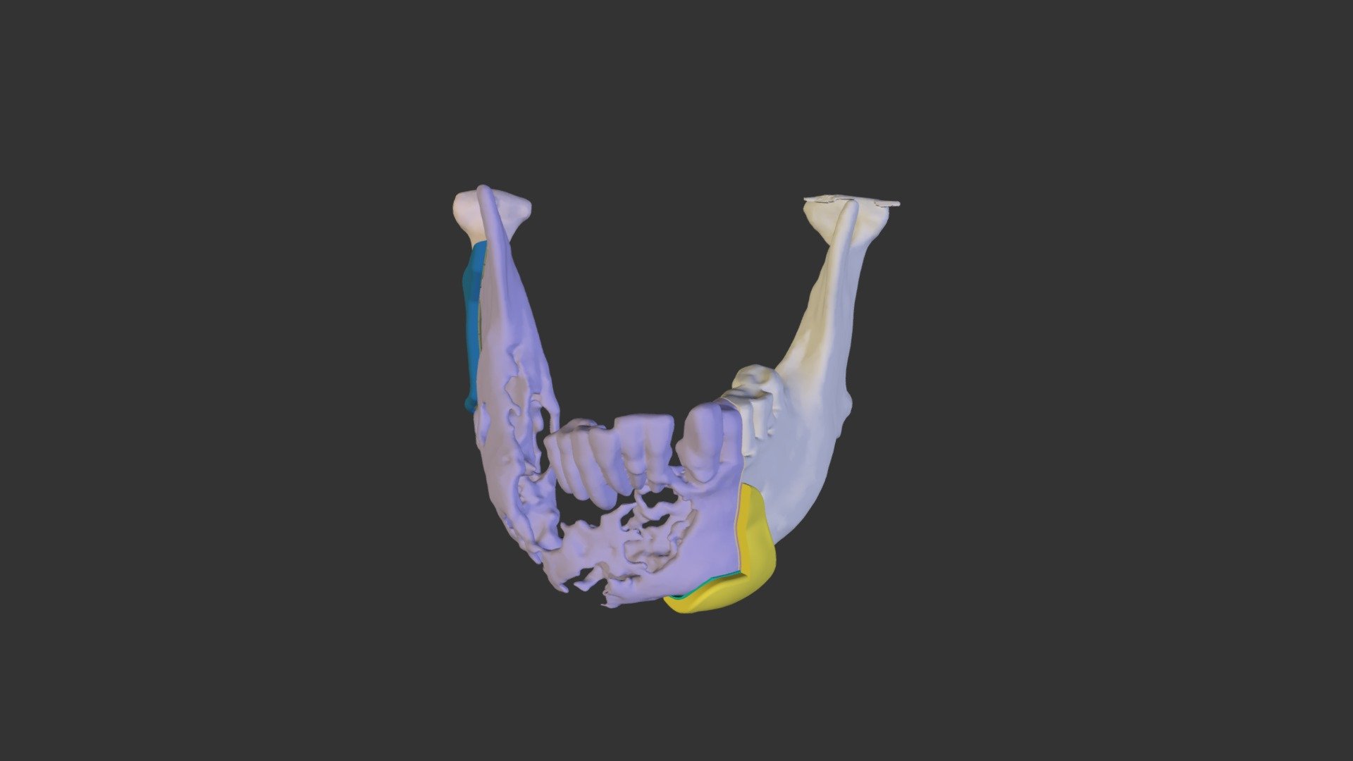 Mandible Cutting Guide-2 - 3D model by EYBioD [819b42d] - Sketchfab
