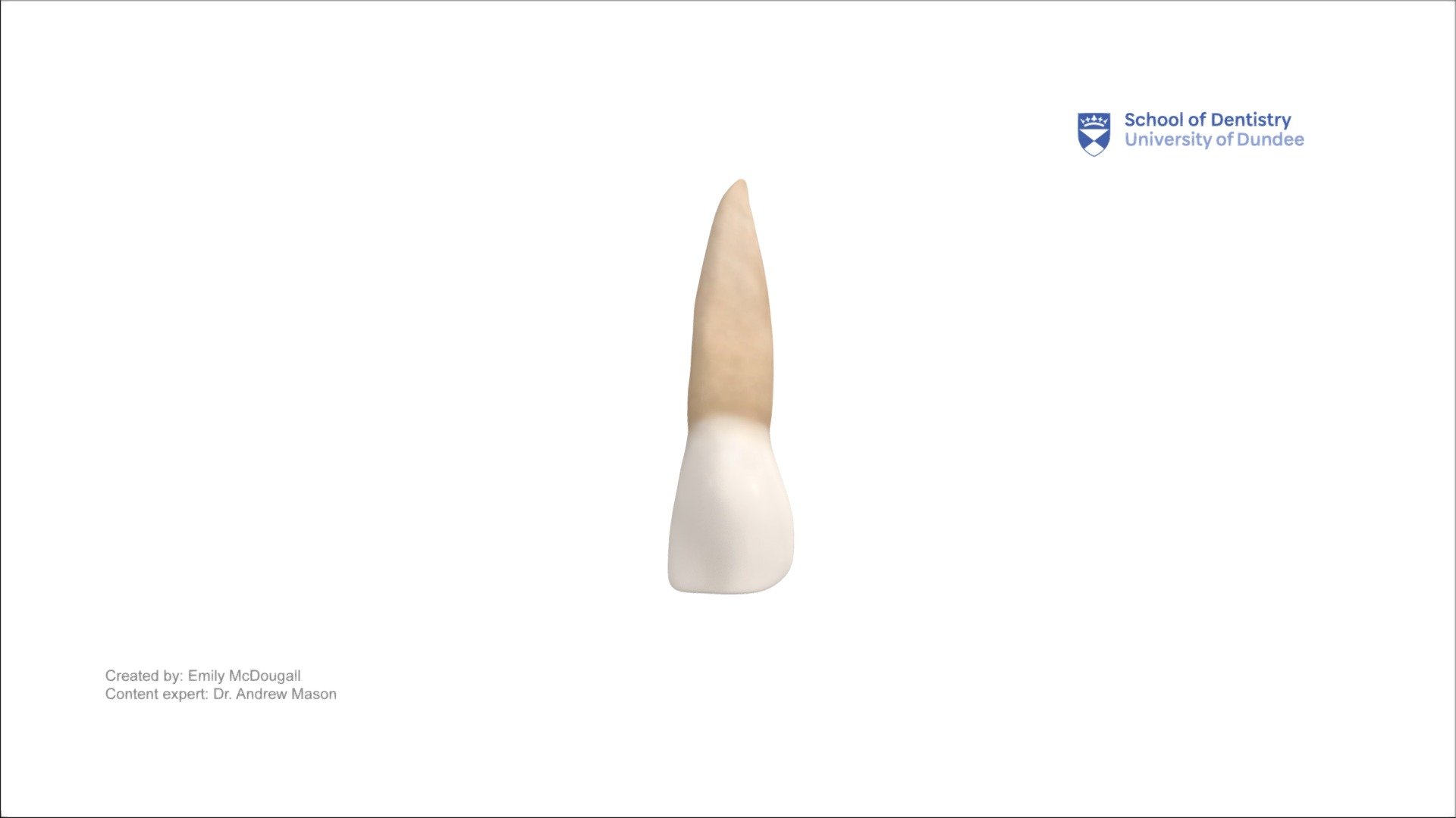 Primary upper left lateral incisor (FDI 62) - Download Free 3D model by ...