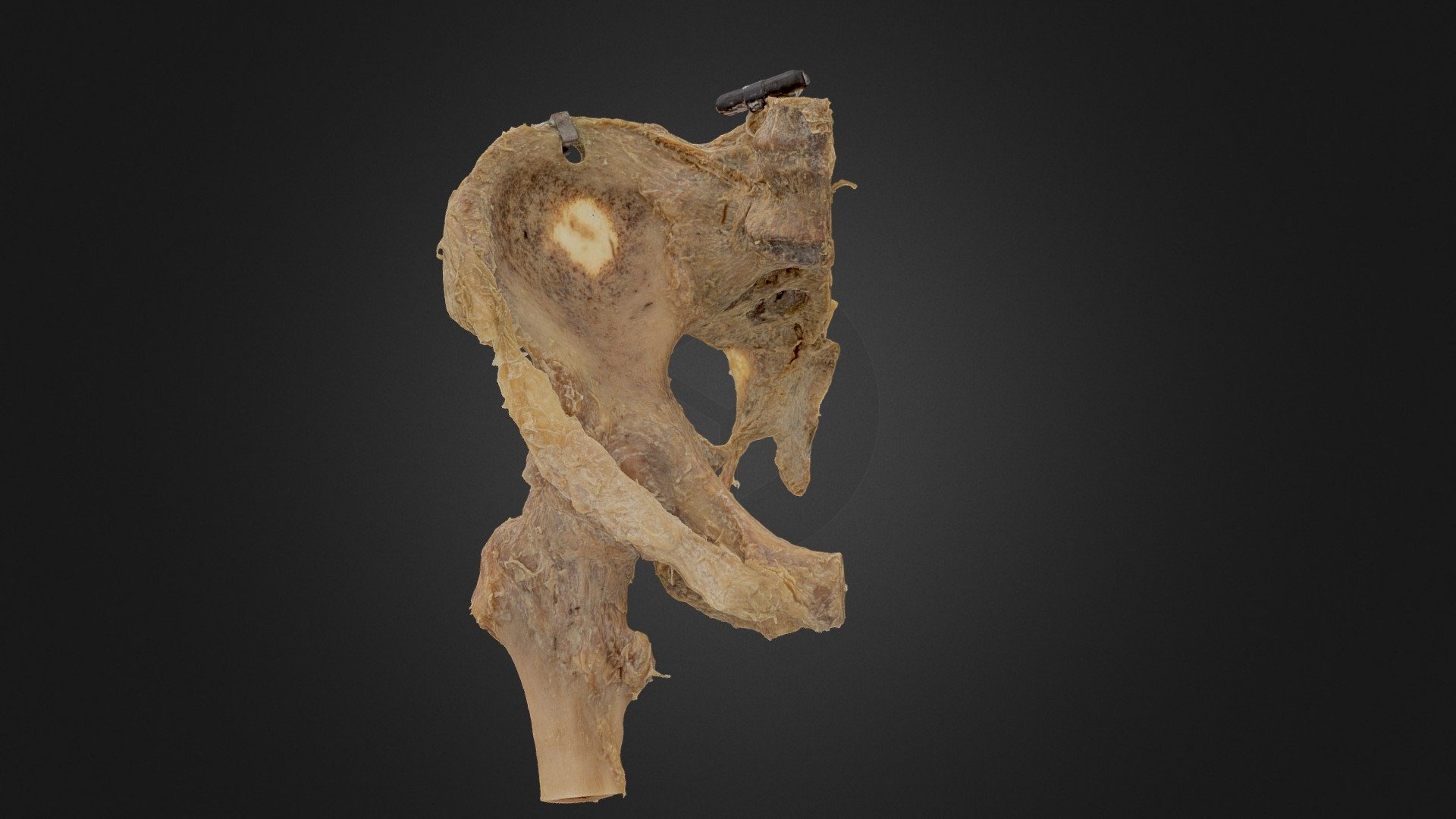 Hip Joint - 3D model by UBC Medicine - Educational Media [827f570 ...