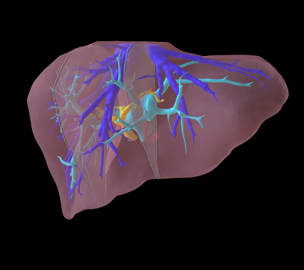 Type II Anatomy [6085] Whole Liver - 3D model by chloroplast [8342a93 ...