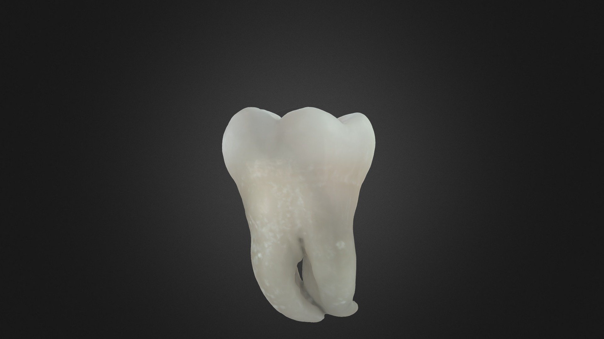 Dente 38 - Lower Left Third Molar (ID 38b) - Download Free 3D model by ...