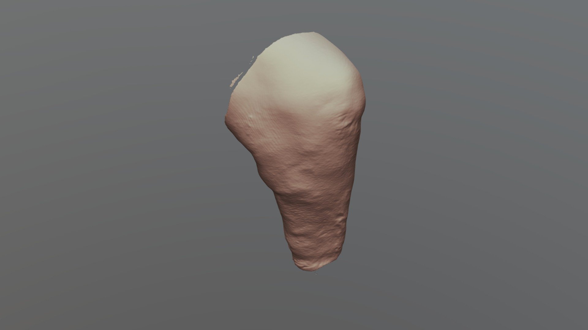 Amputated Leg scan - 3D model by Tashibest [8390020] - Sketchfab