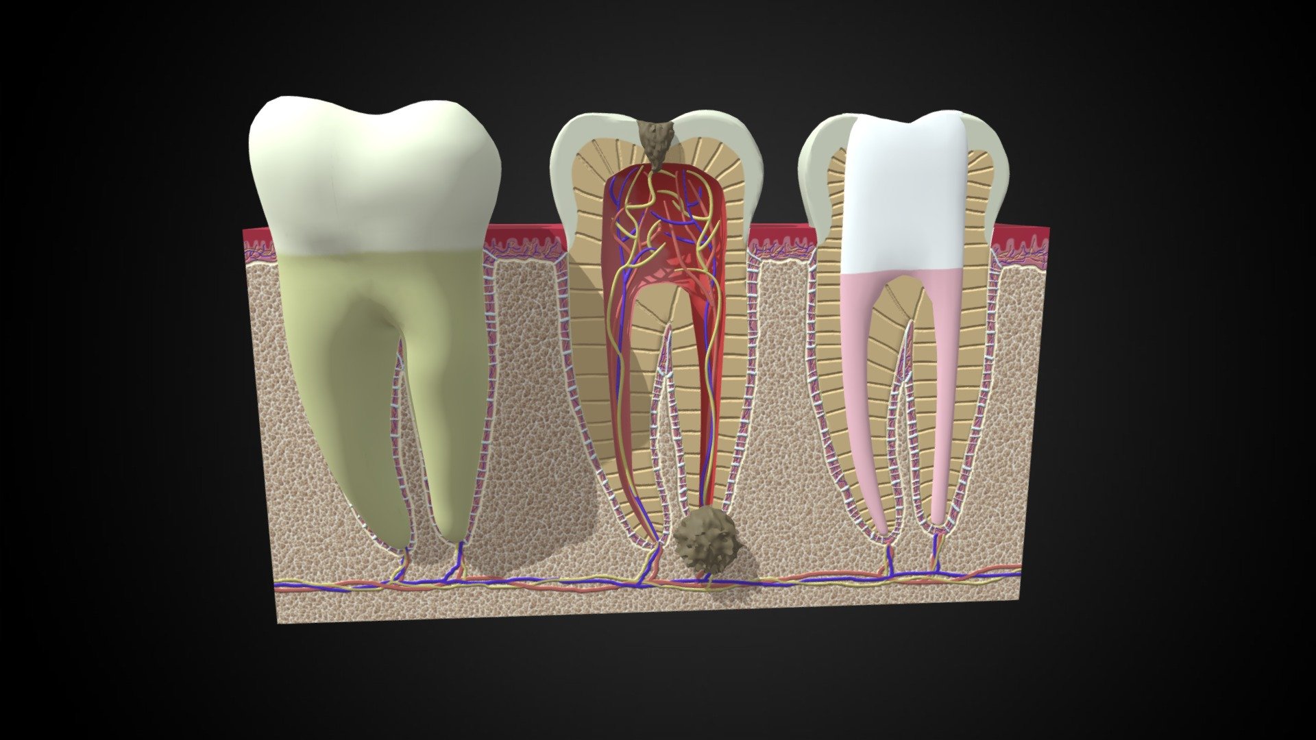 Mandibular Second Molar_final - 3D model by iqcenter [83fb965] - Sketchfab