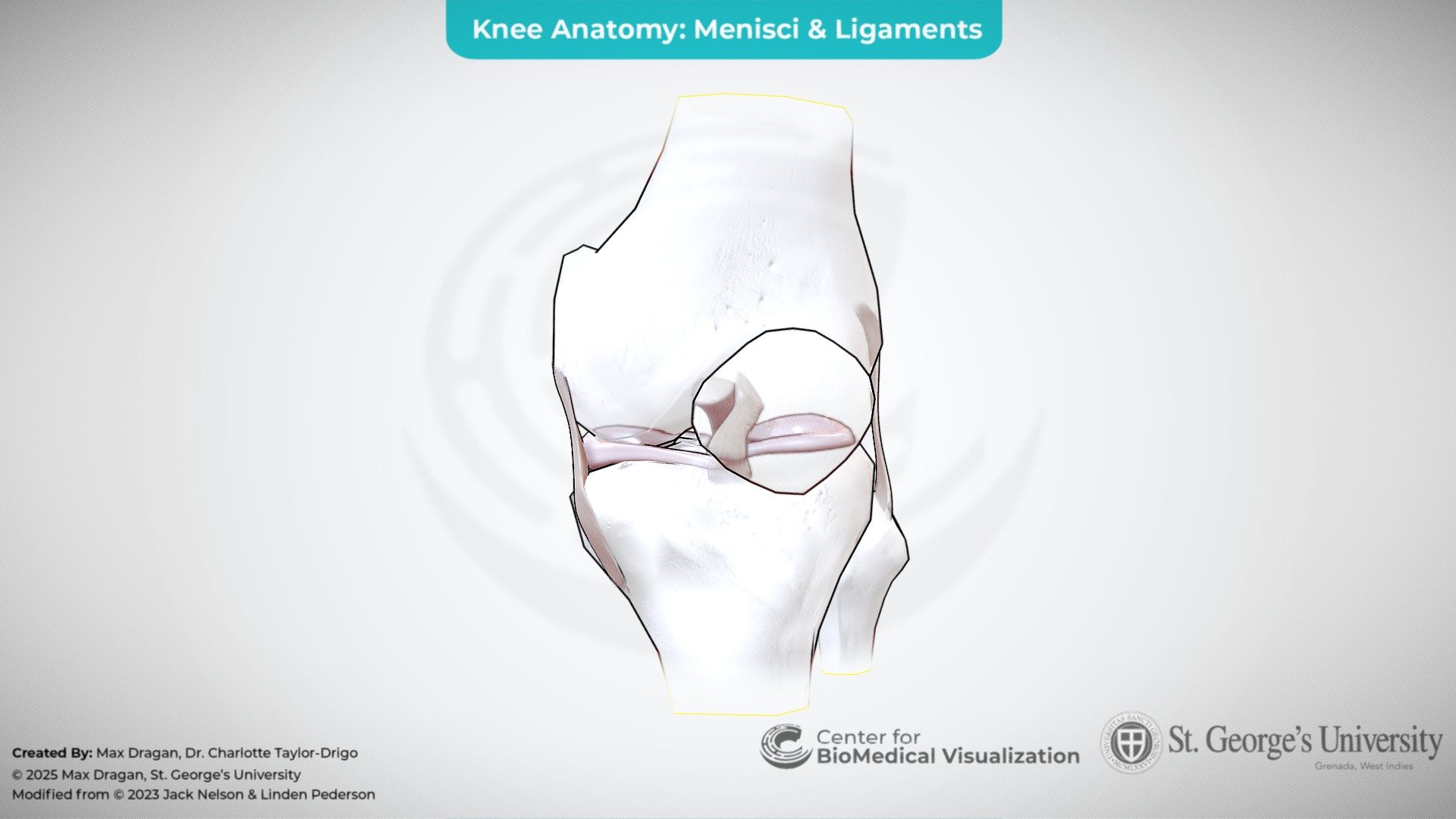 Knee Anatomy: Menisci & Ligaments - 3D model by The Center for ...