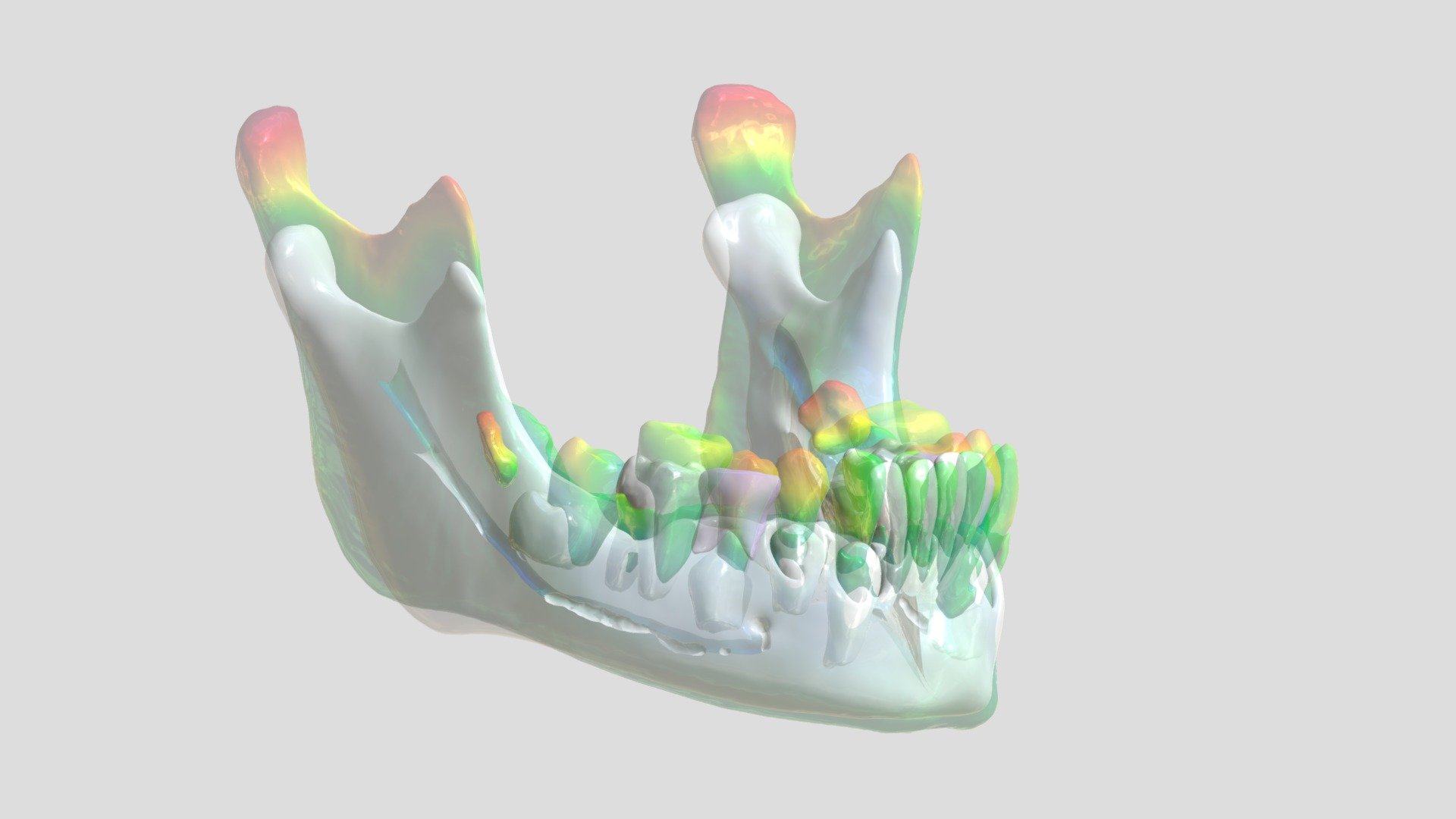 Mandible growth - 3D model by Alexander.Plaksin [848061c] - Sketchfab